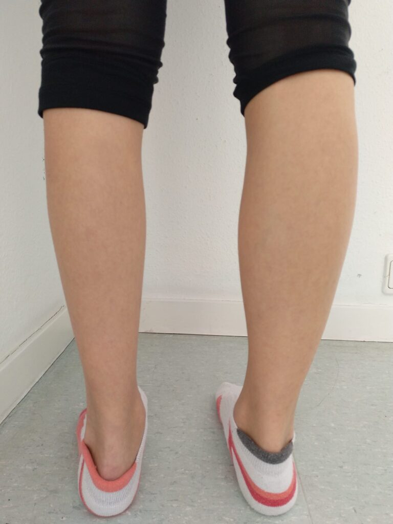 LA IMPORTANCIA DEL TRABAJO ACTIVO PARA TRATAR LA ATROFIA MUSCULAR ...